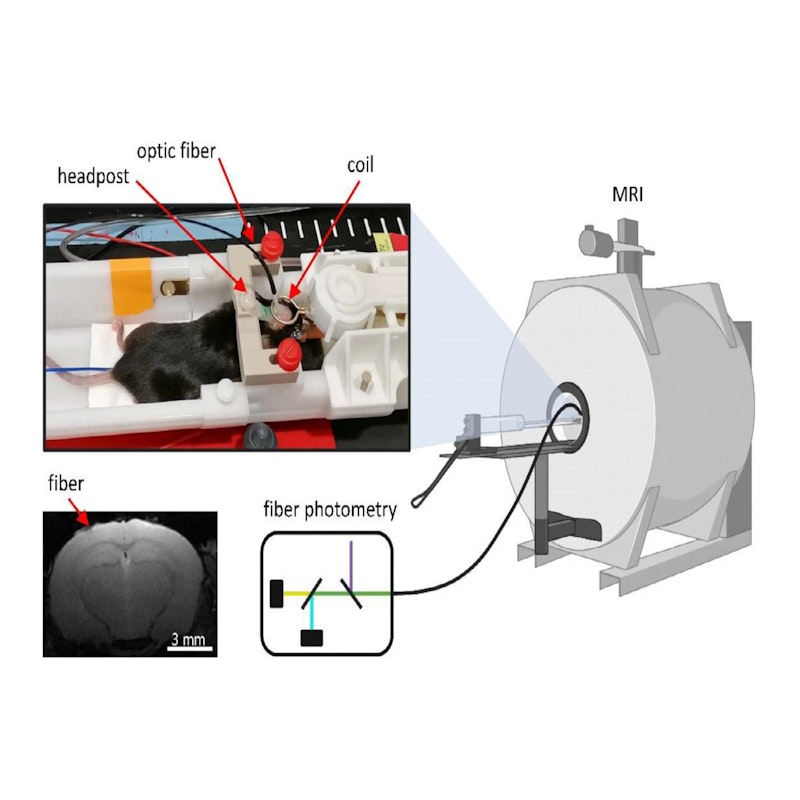 Simultaneous dynamic glucose-enhanced (DGE) MRI and fiber photometry ...