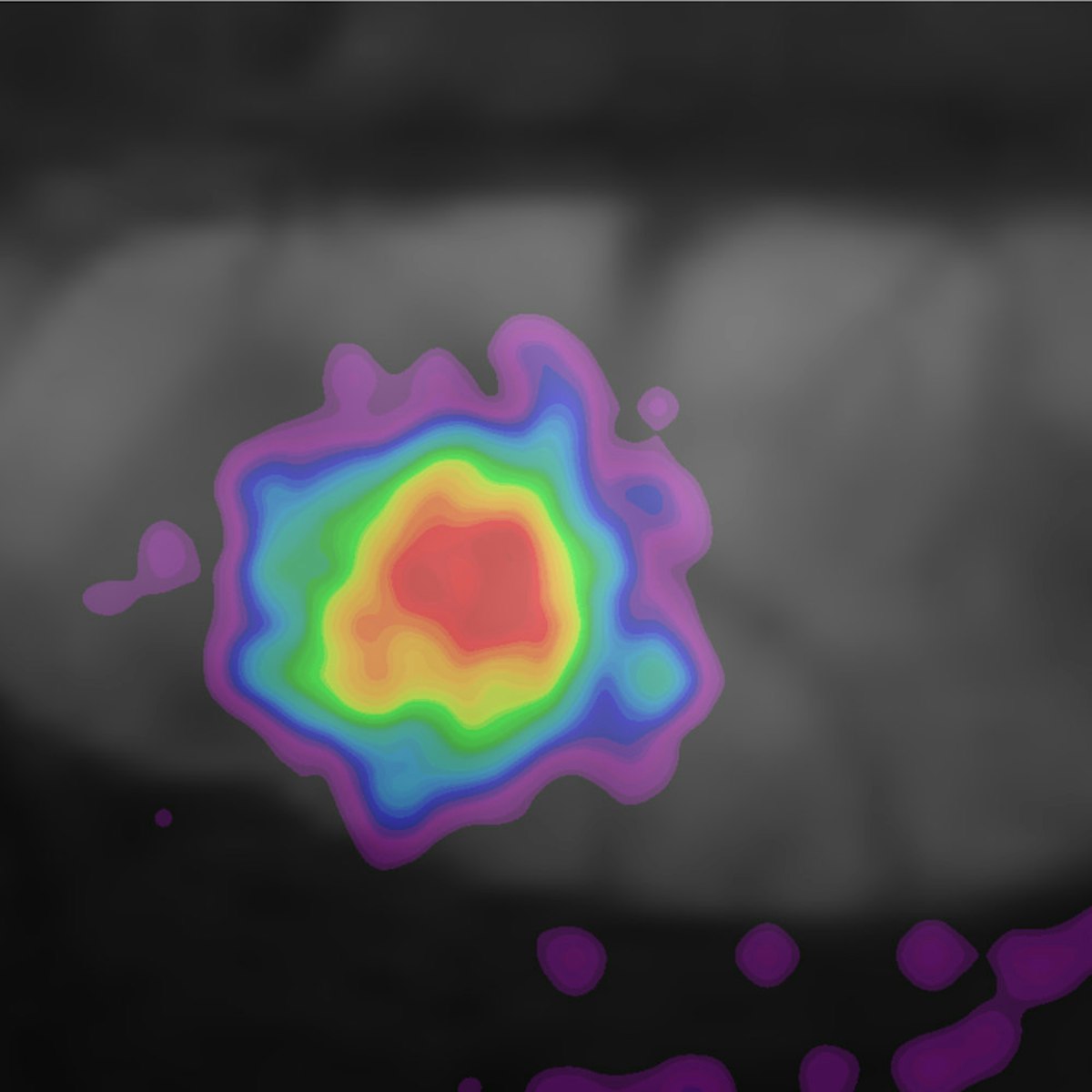 DCC Is Required for the Development of Nociceptive Topognosis in Mice ...