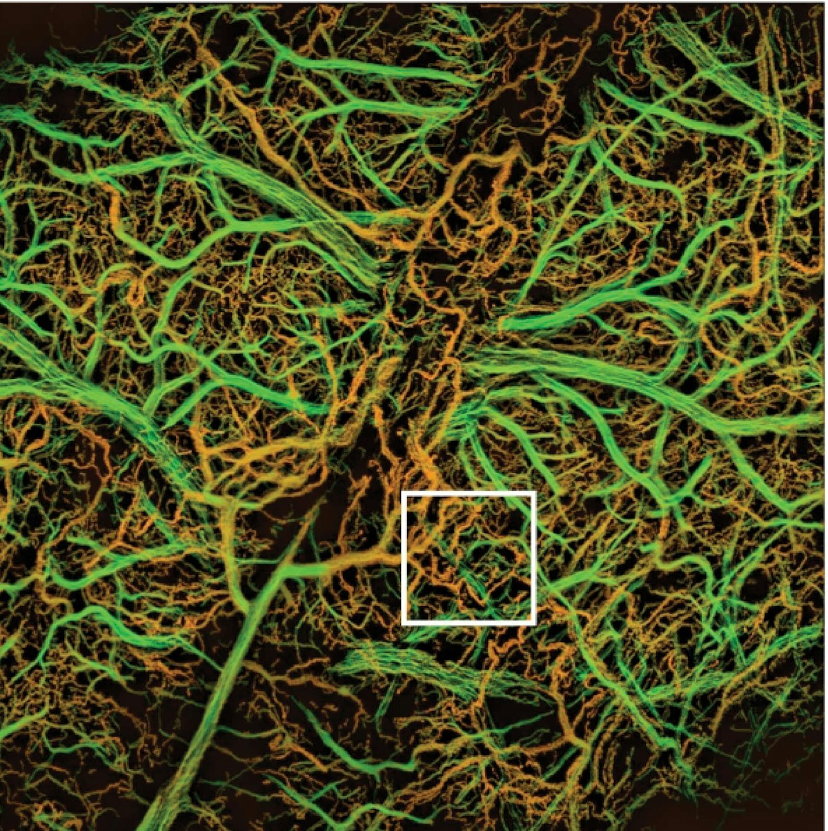 Three-dimensional wide-field fluorescence microscopy for transcranial ...