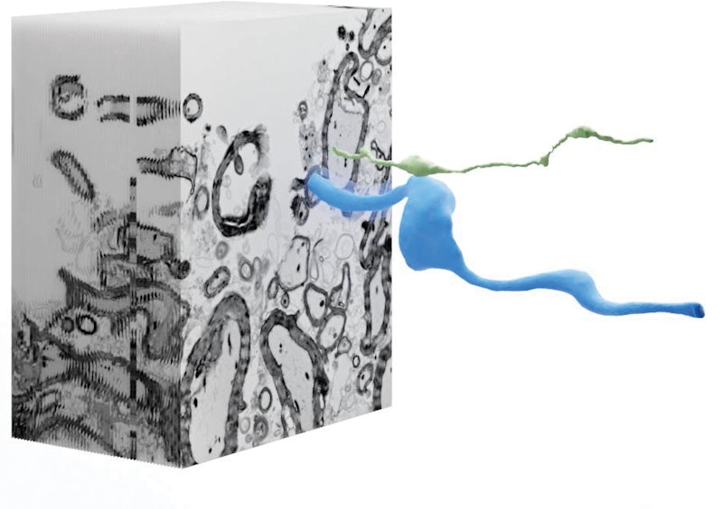 A new form of axonal pathology in a spinal model of neuromyelitis optica
