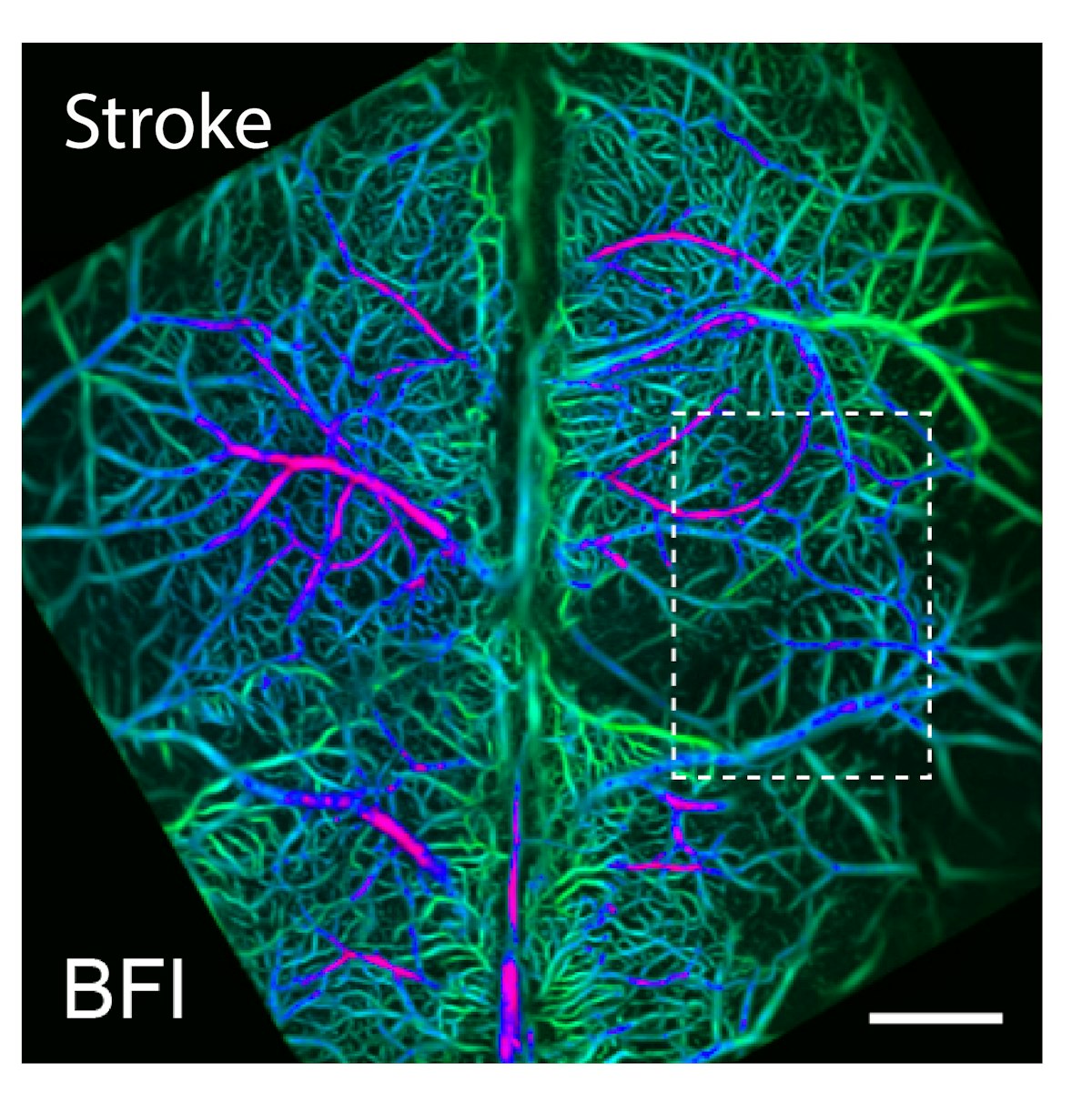 Transcranial Cortex-Wide Imaging of Murine Ischemic Perfusion With ...
