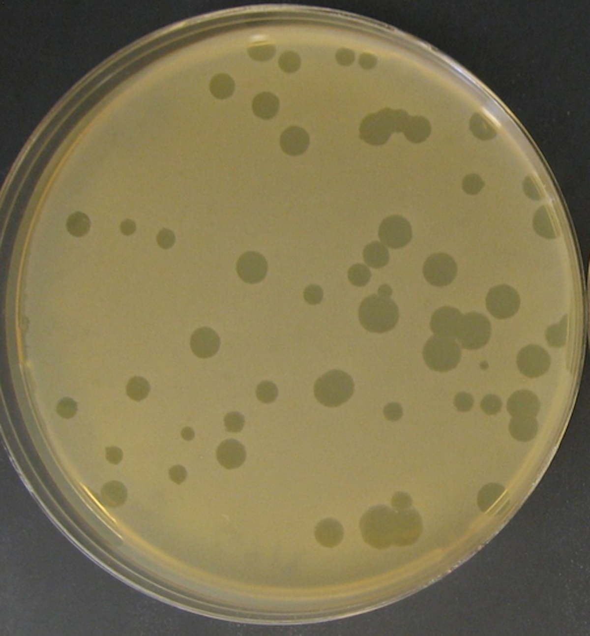 Acne bacteria killed — Science Learning Hub