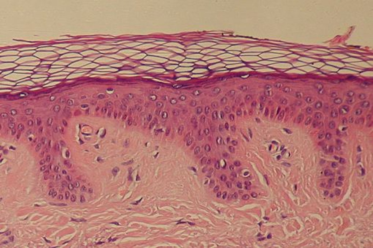 Skin cross-section — Science Learning Hub