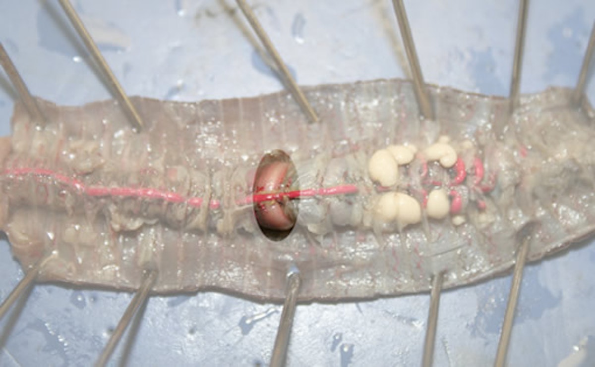 Gizzard — Science Learning Hub