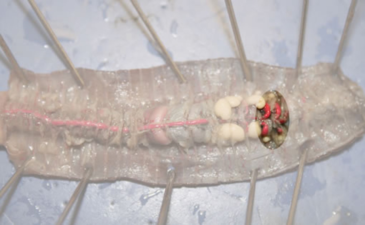 Aortic arches — Science Learning Hub