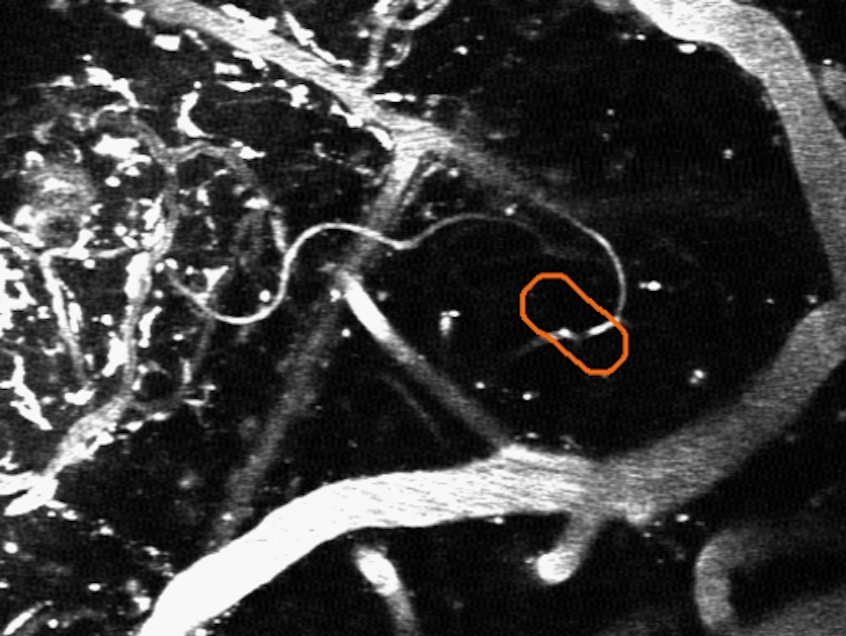 Blood vessels in a mouse brain — Science Learning Hub