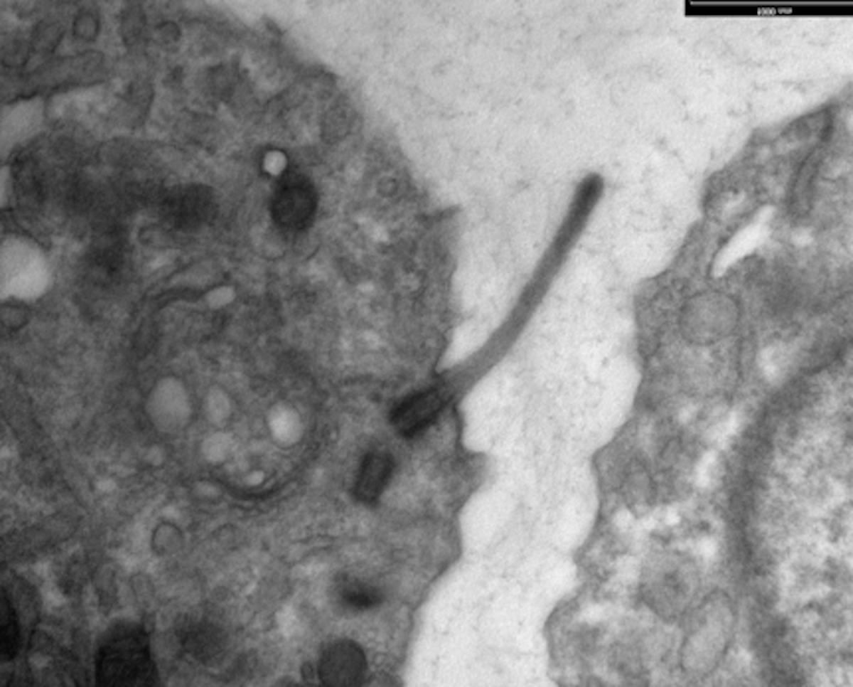 Primary cilium (width) — Science Learning Hub