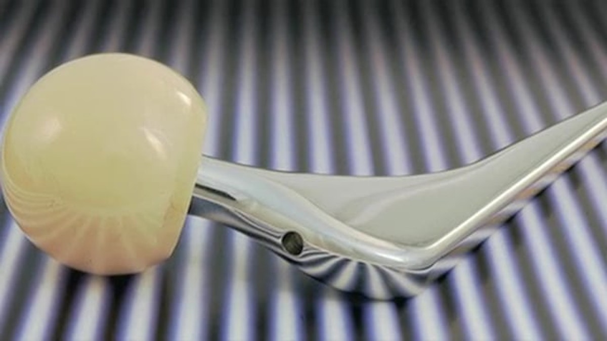 What are bioceramics and biomaterials?