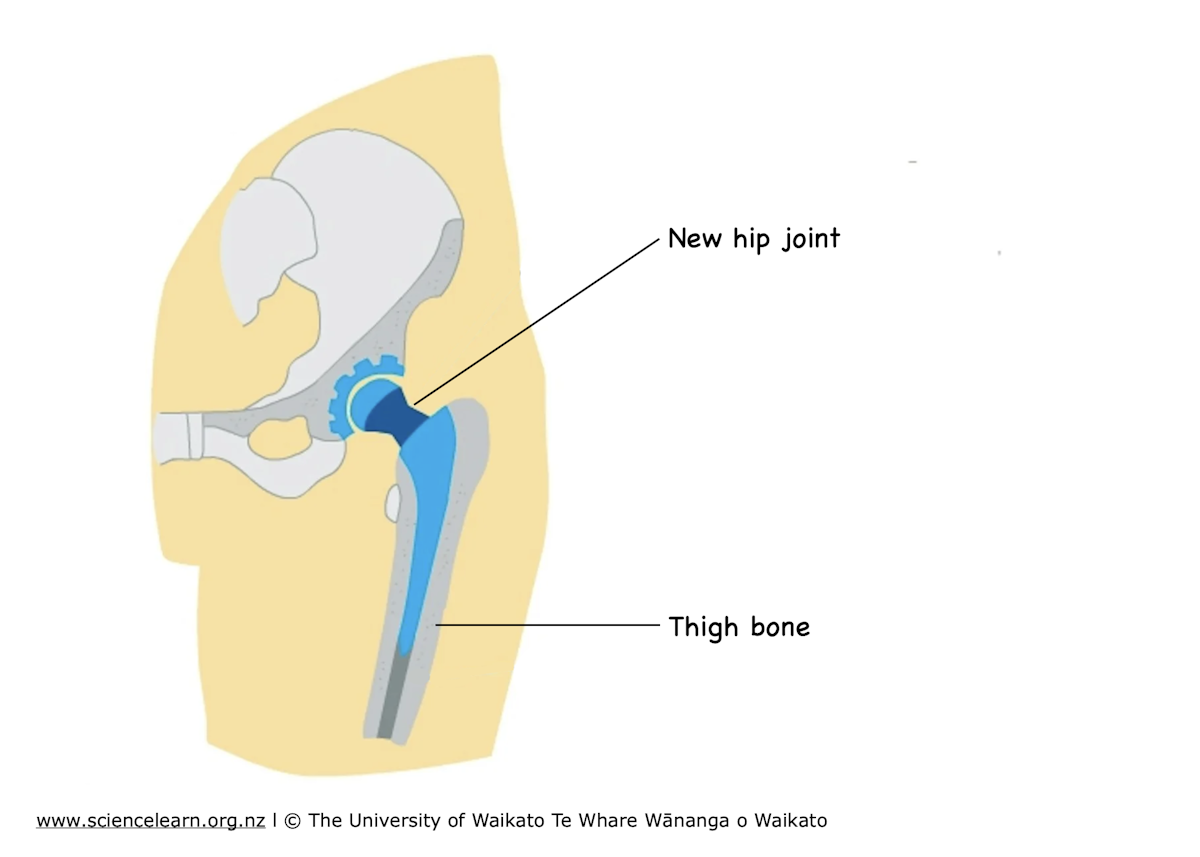 Hip joint — Science Learning Hub