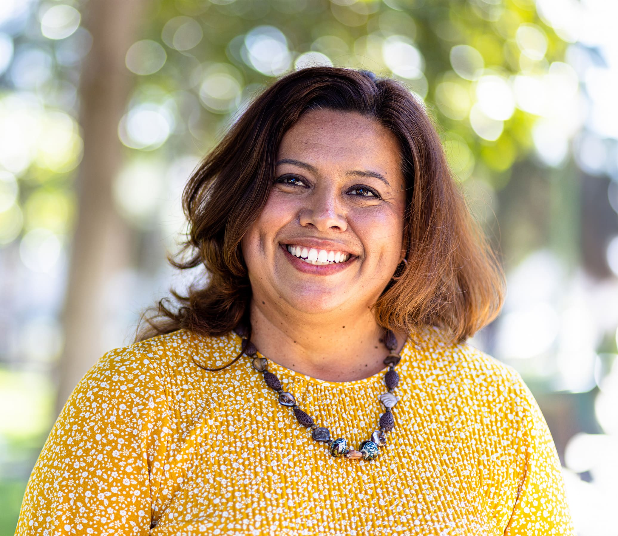 How Long is the Lasik Surgery Recovery Time | Dello Russo