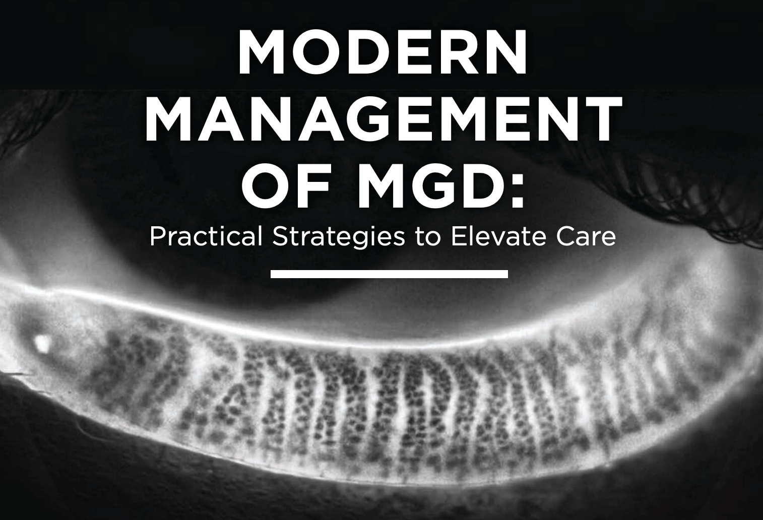 Dr. Raviv Featured in Monograph on MGD – Eye Center of New York