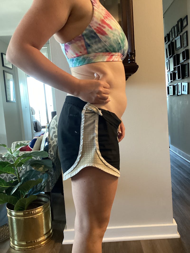 Patient 276015 Semaglutide Before And After Photos Images Med Spa