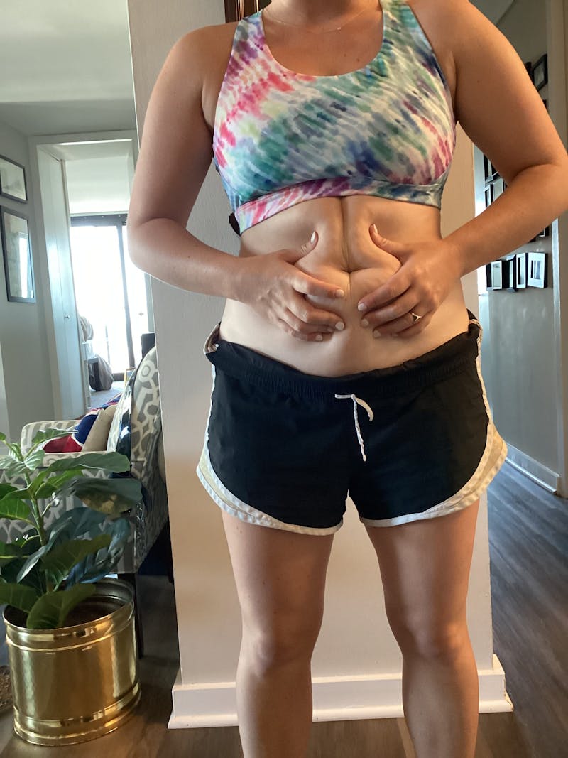 Patient 276015 Semaglutide Before And After Photos Images Med Spa