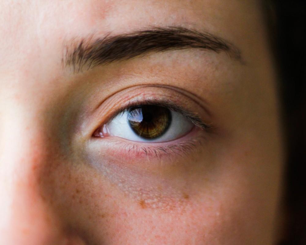 What causes dark circles under your eyes store