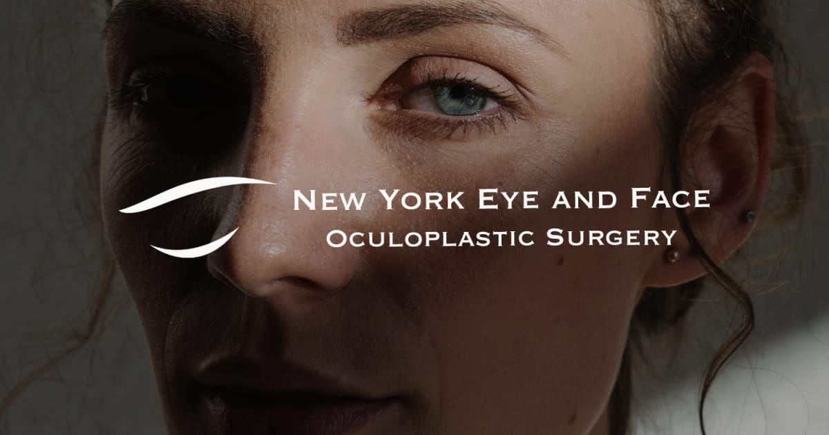 Patient 412579 | Upper Blepharoplasty Before & After Photos | New York Eye and Face Oculoplastic ...