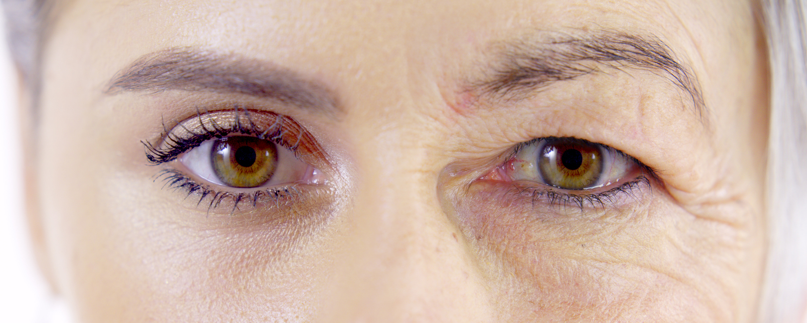 Upneeq: The Non-Surgical Solution to Drooping Eyelids and Tired Eyes ...