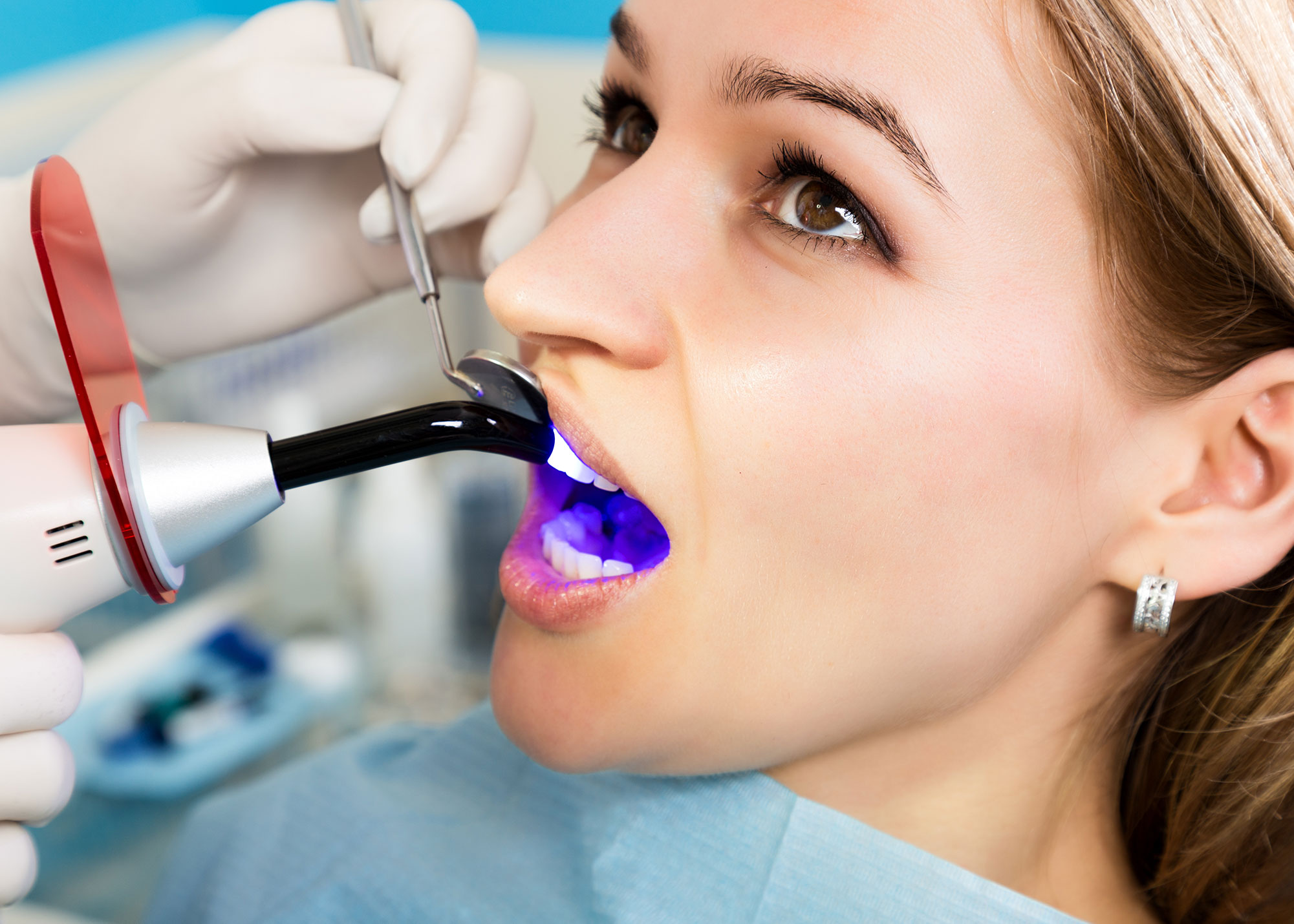 Dental Bonding To Fix Gaps In Teeth - Sinada Dental