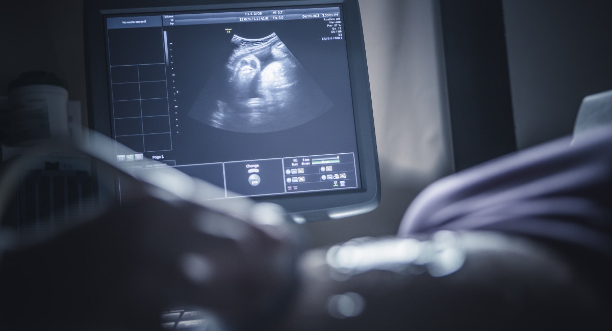 OB/GYN organization launches campaign against false abortion media ...