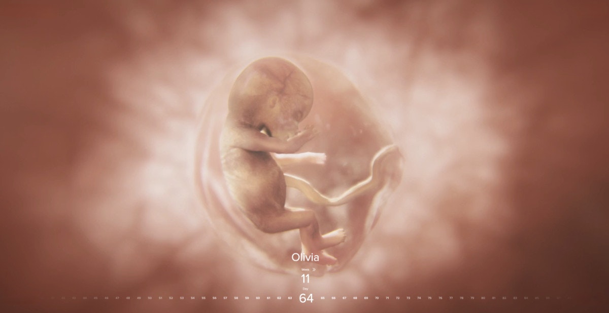 Live Action launches unprecedented interactive ‘Window to the Womb’ web ...