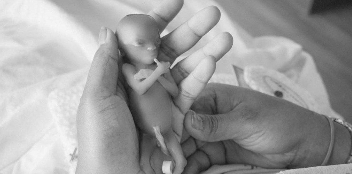 What Does A 20 Week Fetus Look Like