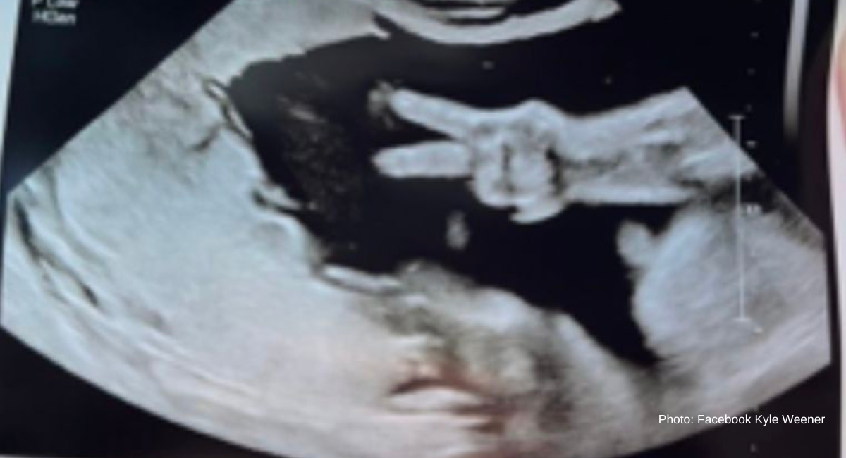 ‘Peace out!’ Preborn baby flashes her parents the peace sign on ...