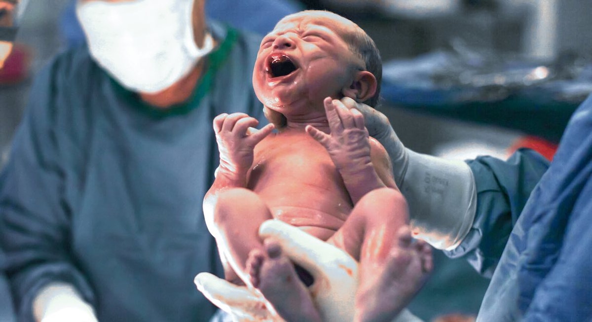 ‘Pro-birth’: Without the right to life, there can be no other rights ...