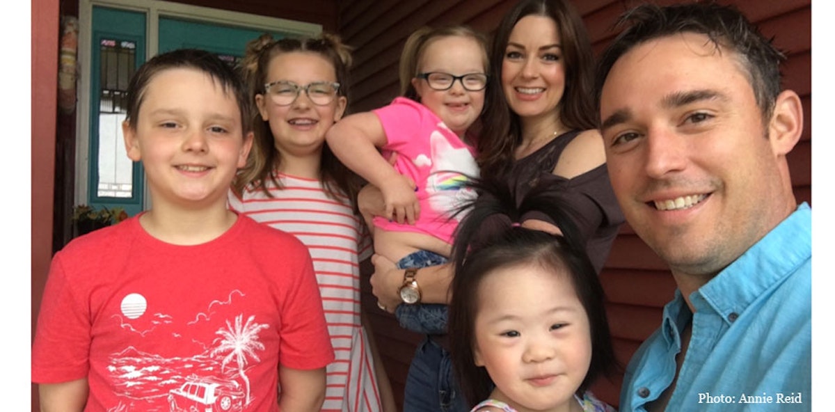 From Ollie to Edie: Family of two girls with Down syndrome say ‘life is ...