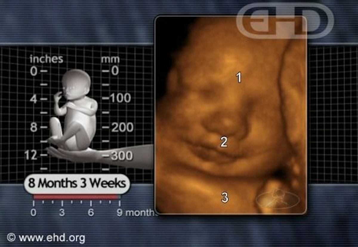 New study shows that preborn babies may be able to distinguish ...