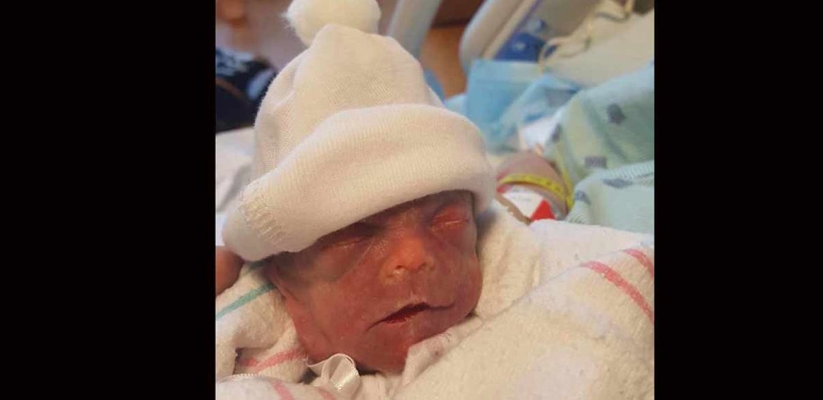 Mother ‘compelled’ to share photos of 24-week stillborn daughter ...