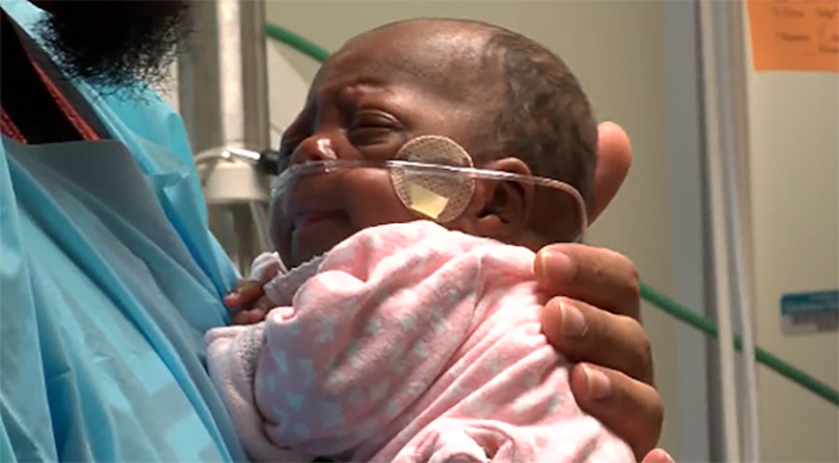 Born at 10 ounces, baby E’layah is one of the smallest babies in the ...
