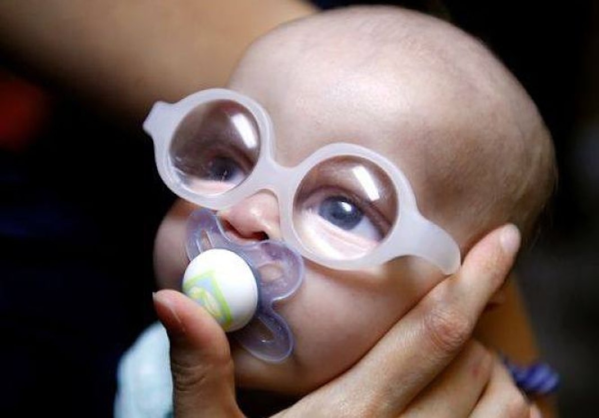 Baby Elliot, born with rare medical condition, shares the preciousness ...