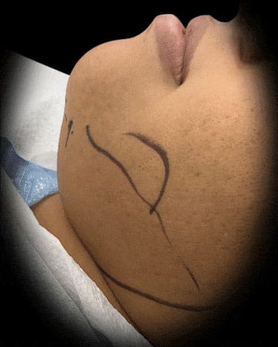 Before & After GIFs | Dr. Anil Shah