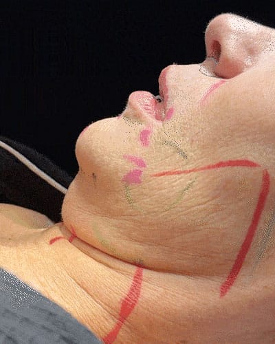 Before & After GIFs | Dr. Anil Shah