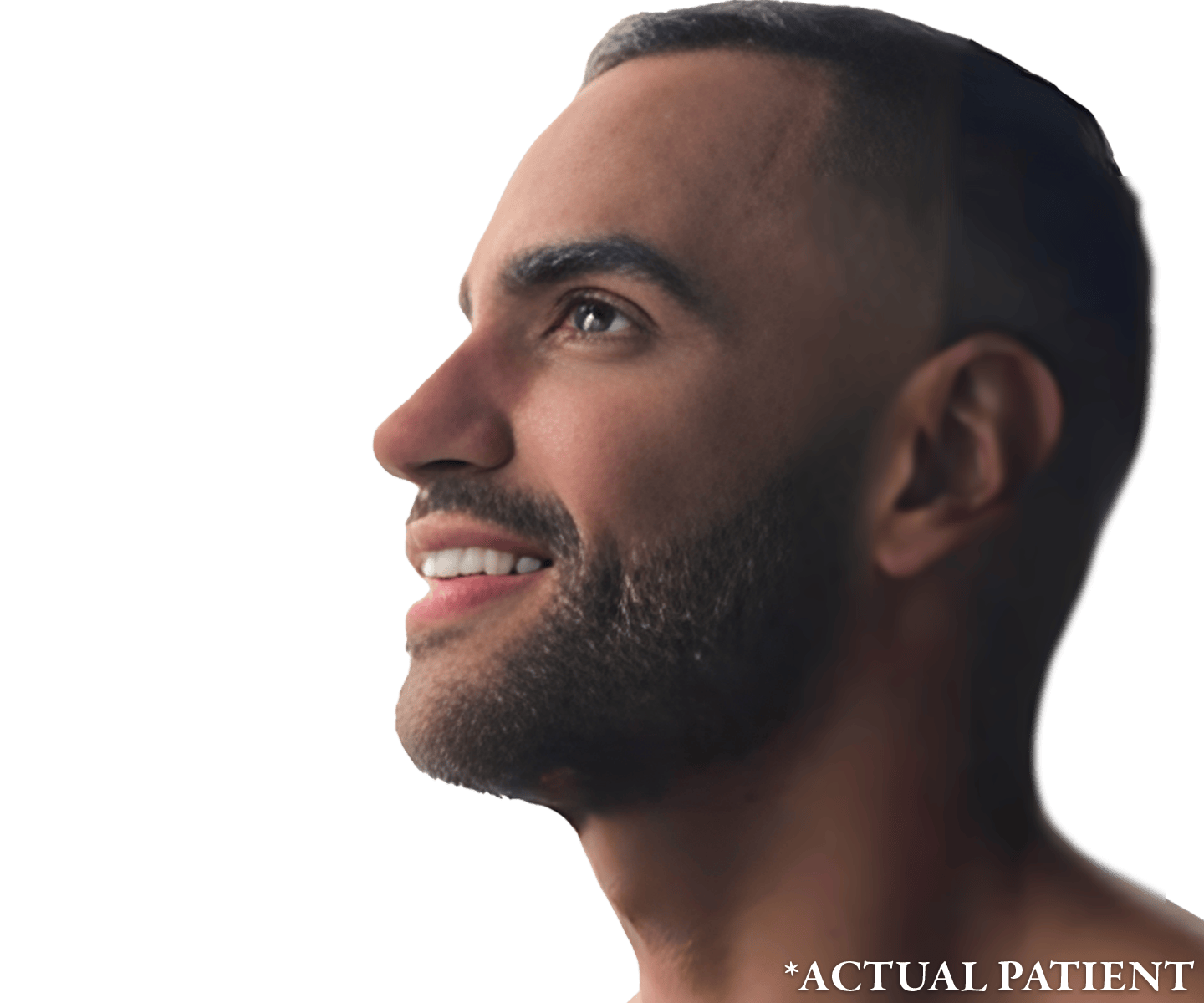 Otoplasty Chicago, IL | Ear Surgery in Chicago | Dr. Anil Shah