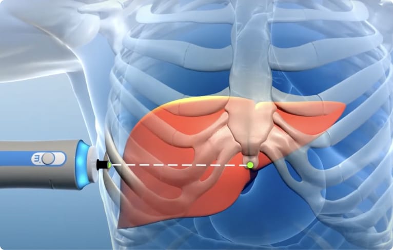 Gastroenterologist Lone Tree | GI Doctor Lone Tree