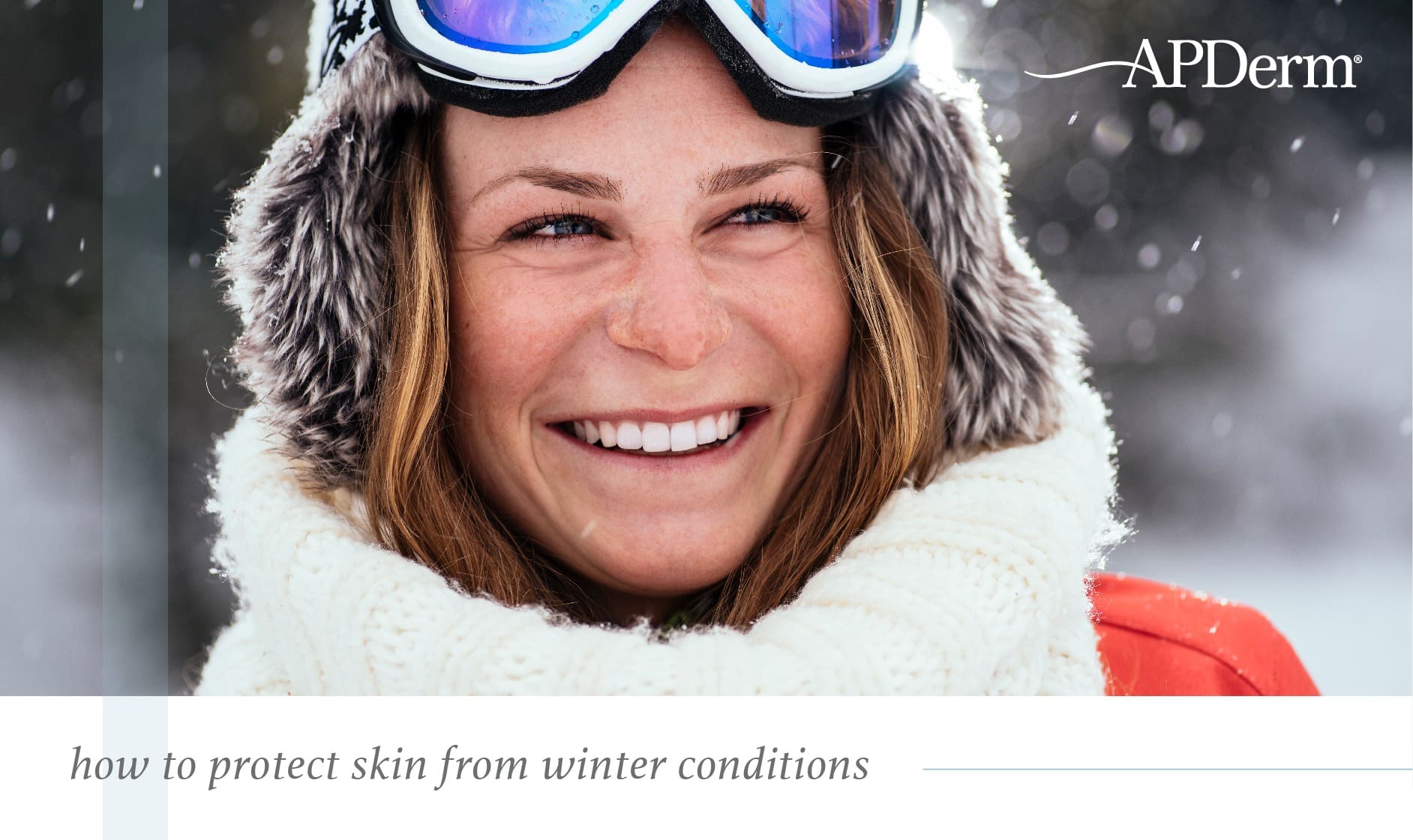 How to Protect Skin from Windburn | APDerm