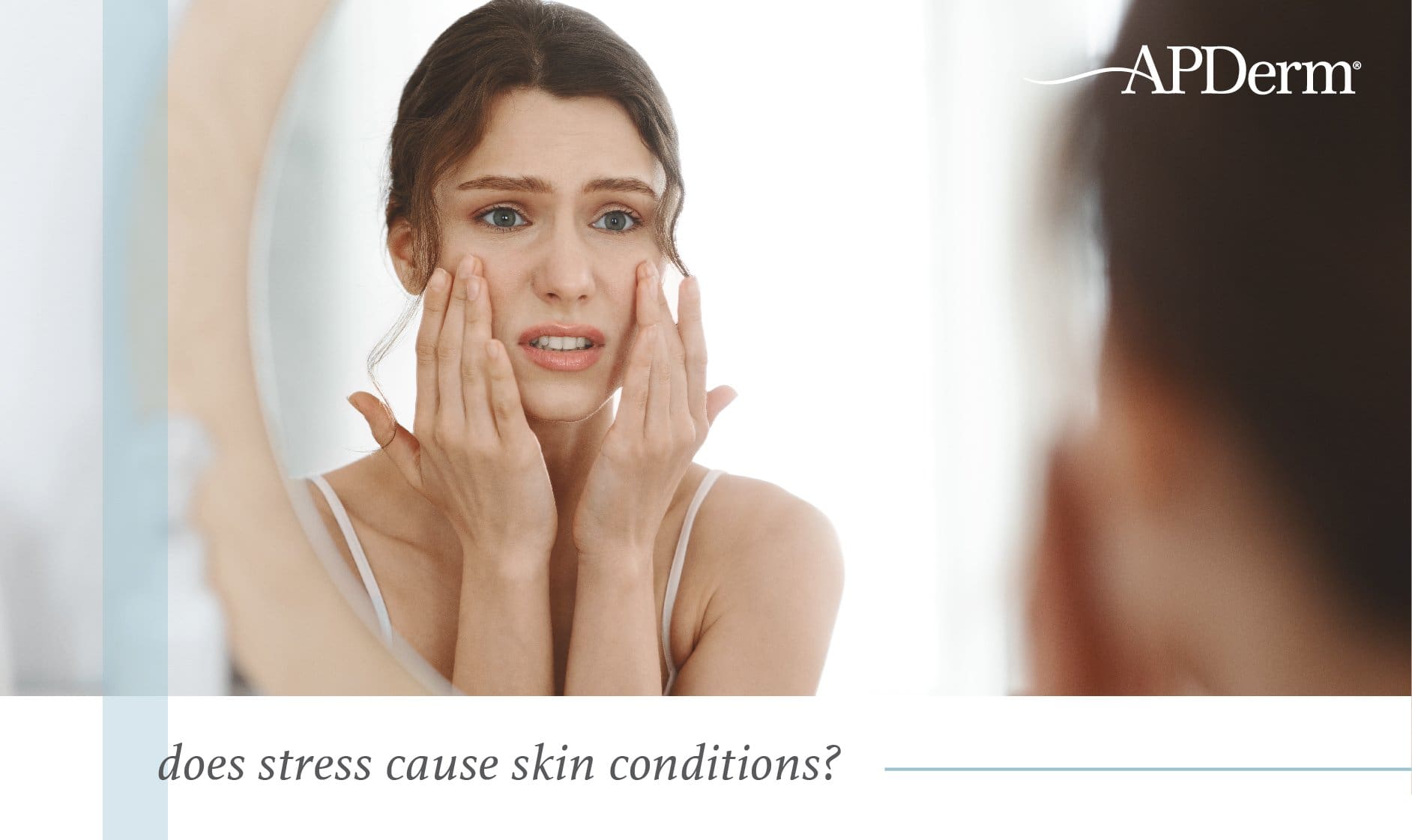 Skin Conditions Caused by Stress and Anxiety | APDerm