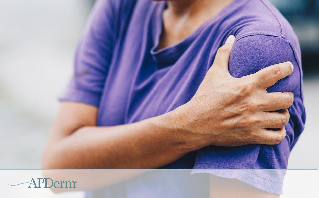 What causes ‘vaccine arm’ and can it be treated?