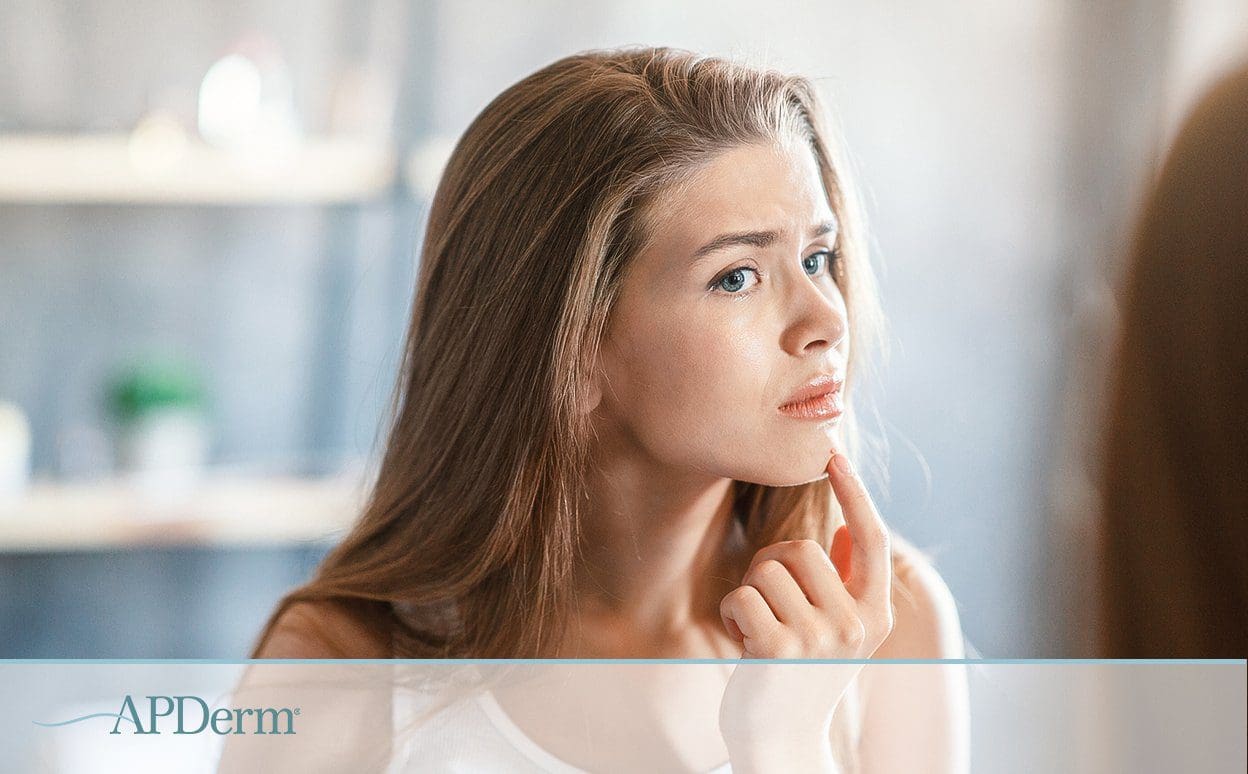 Here are five things to stop doing for clearer skin