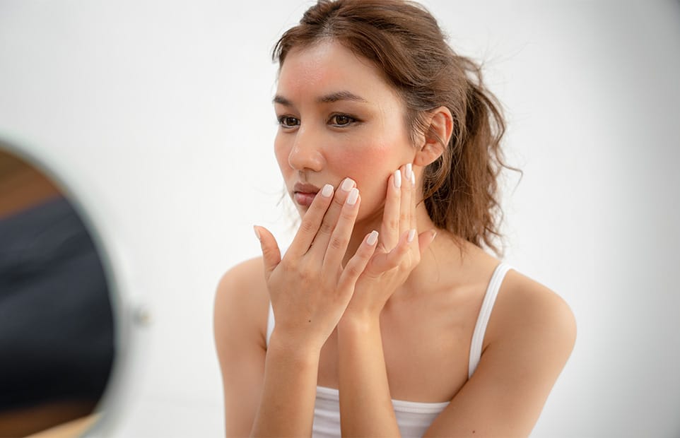 Rosacea 101: What It Is & How to Manage It | Blog | APDerm
