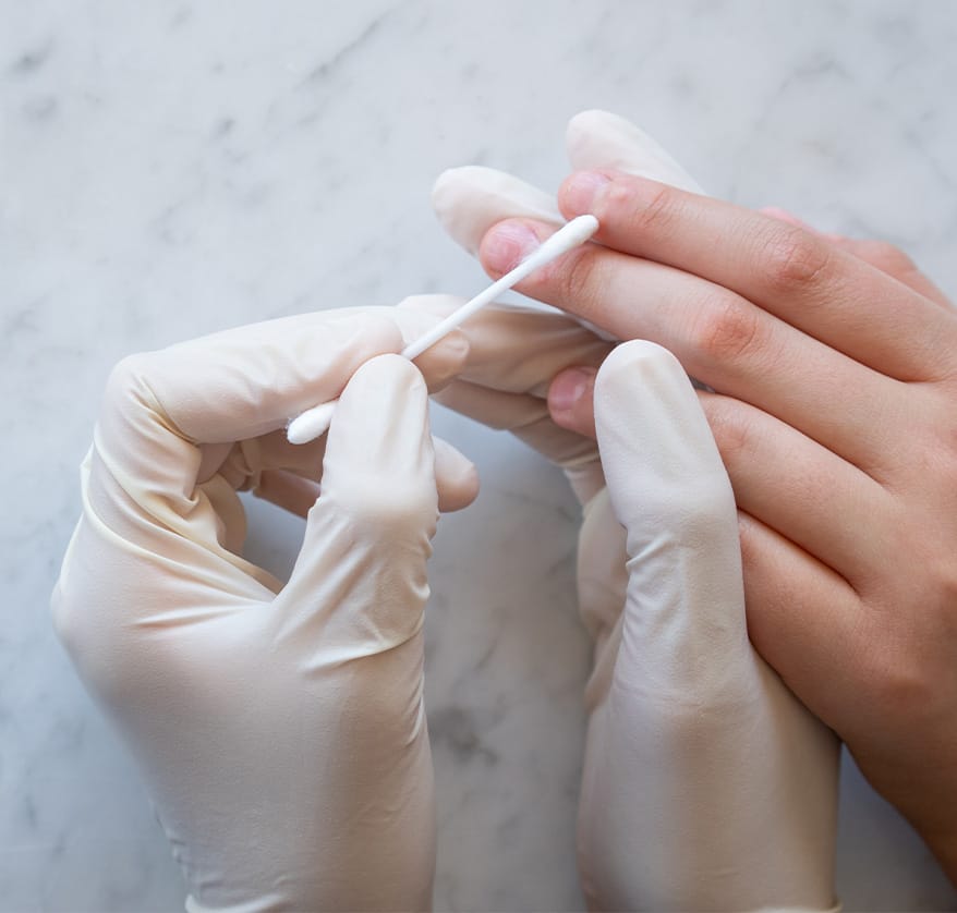 Common Warts - Everything You Need To Know | APDerm