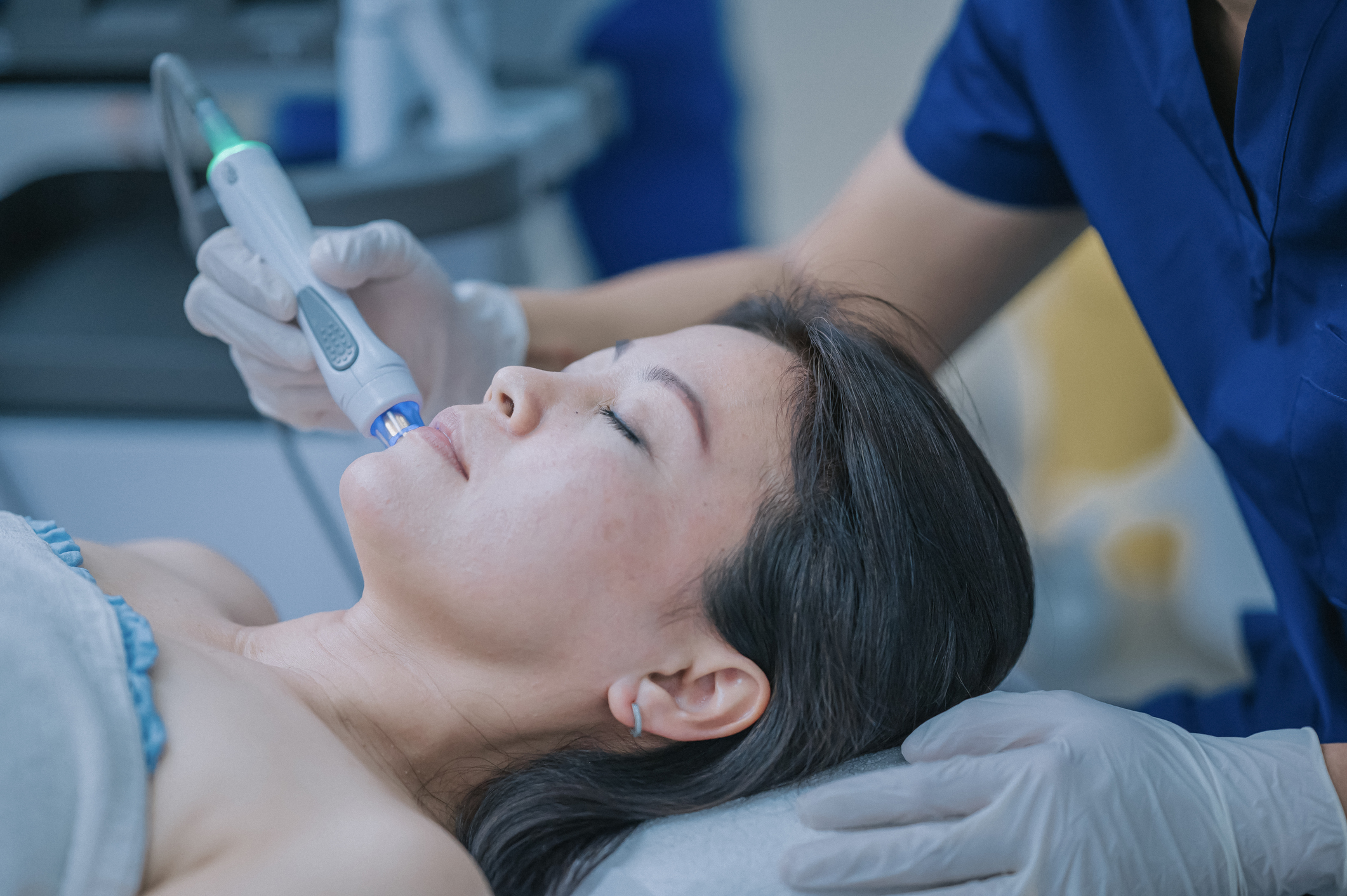 What Is a Pulsed Dye Laser? A Guide to Redness, Rosacea, and Vascular ...