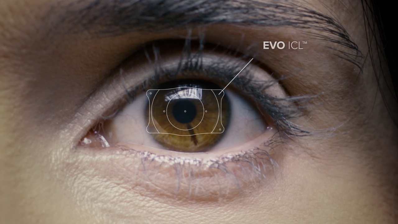 EVO ICL South Bay | EVO ICL in Torrance, CA