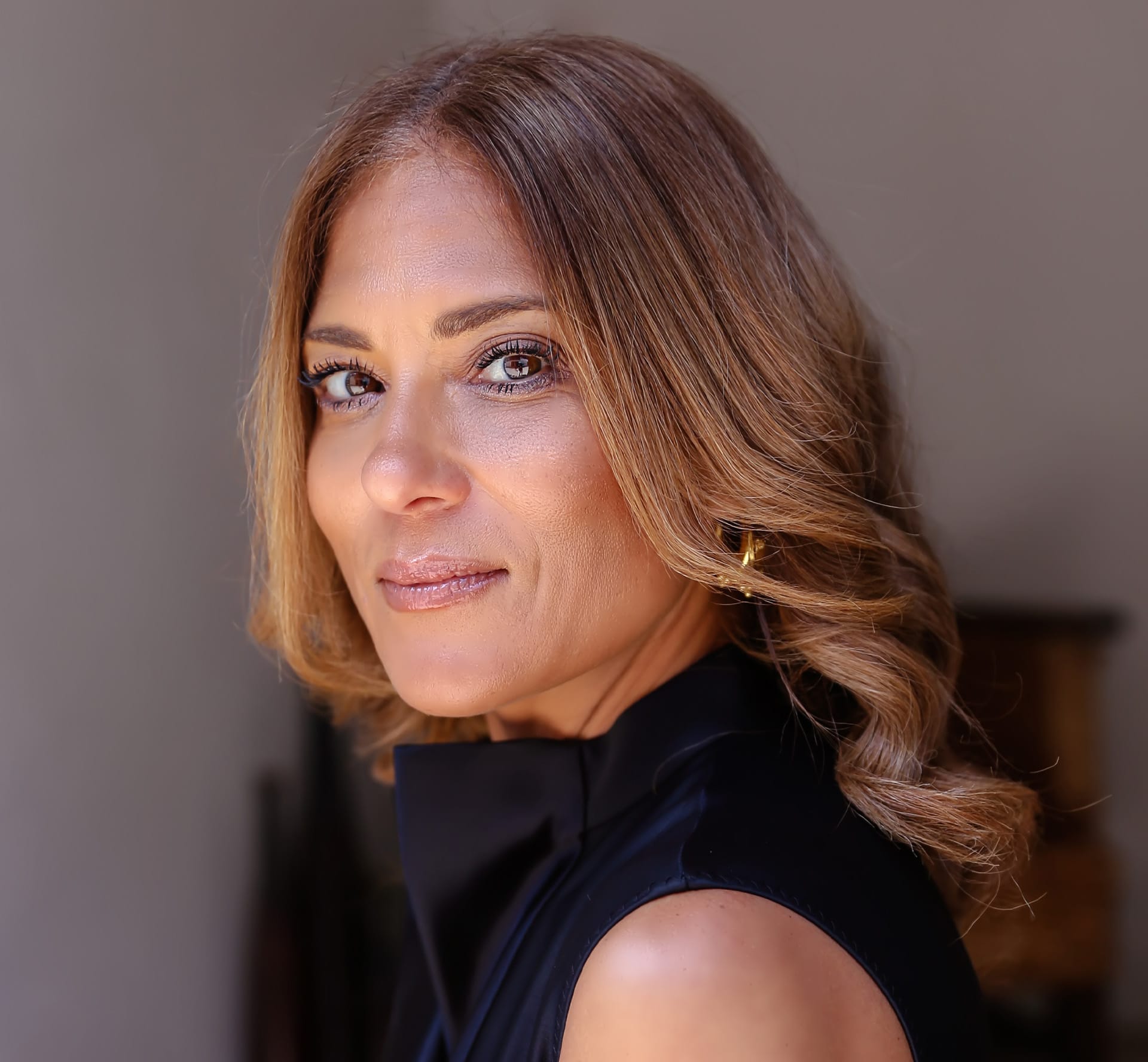 Cheek Lift in Richmond, VA | Matthew Bridges M.D. FACS