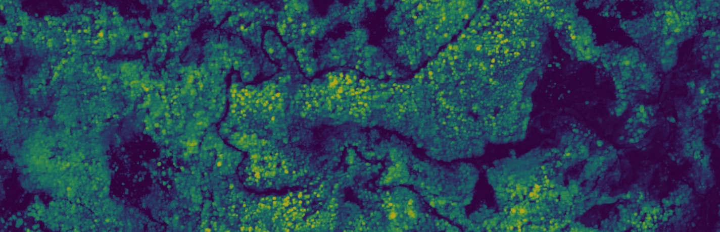 AI for Global Nature Monitoring— Land & Carbon Lab