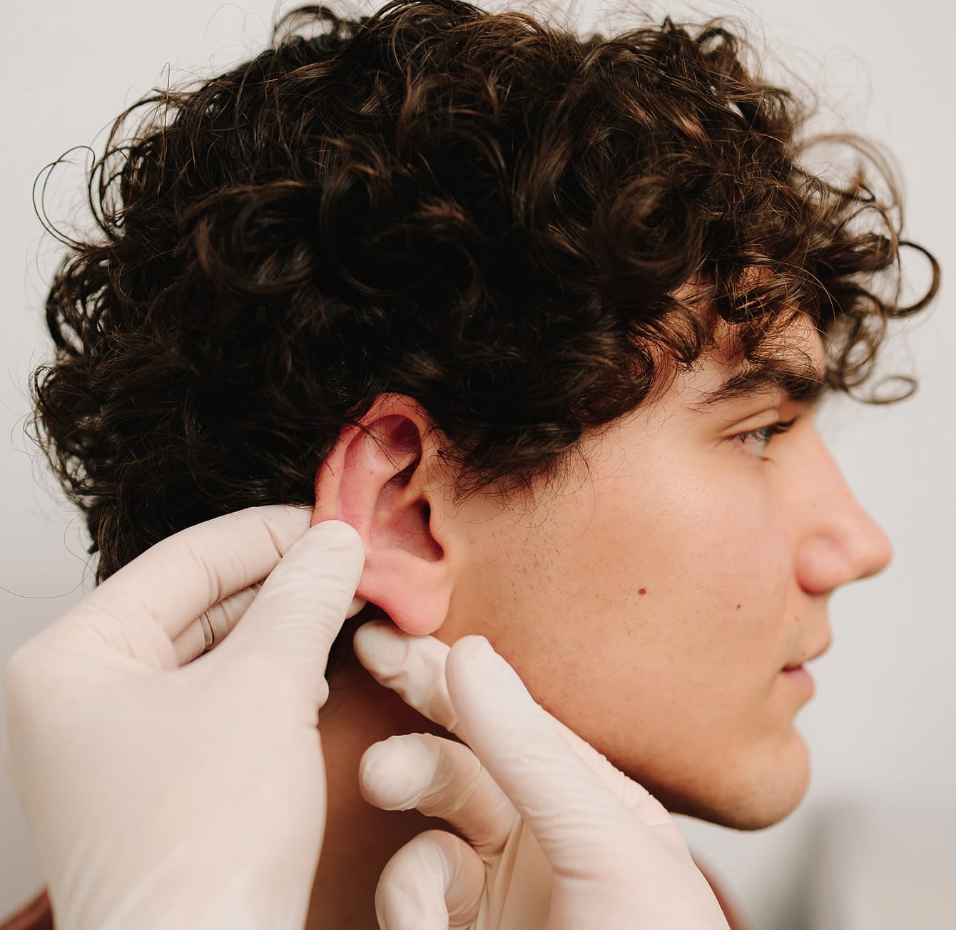 Congenital Ear Deformities in Boynton Beach & Jupiter, FL | ENT ...