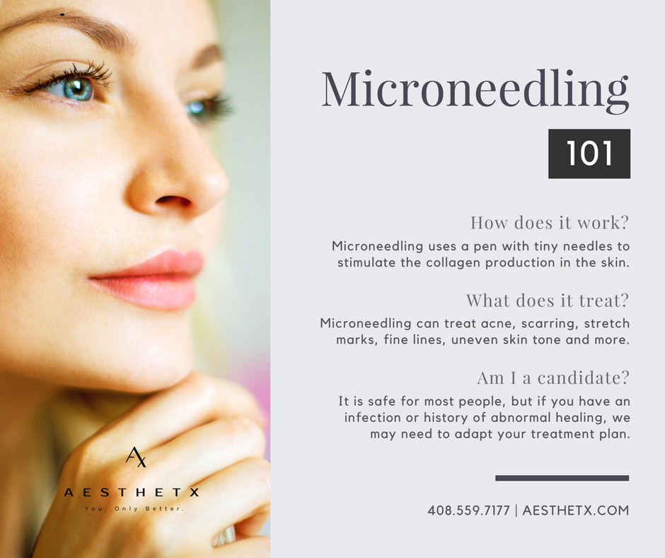 Microneedling 101 - San Jose, CA - Aesthetx Plastic Surgery