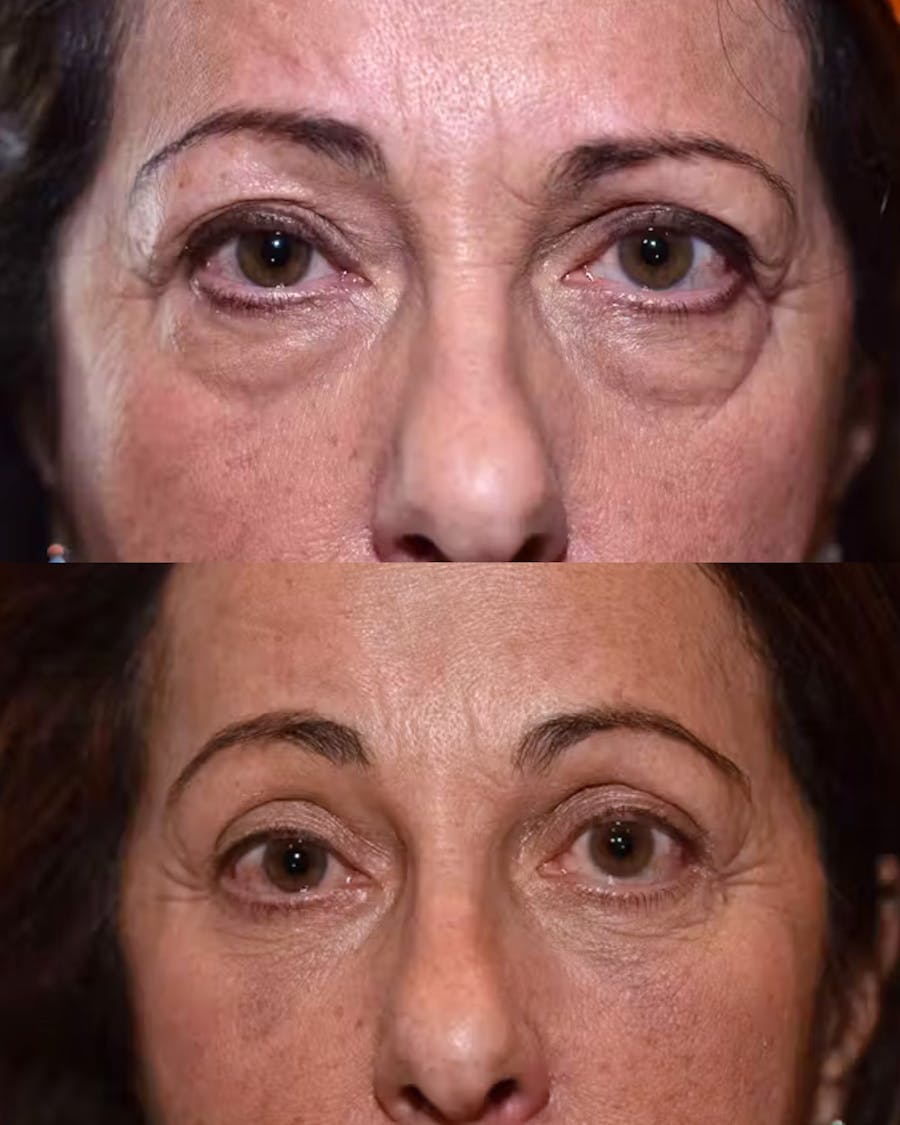 Cosmetic Facial Surgery Options Before & After Photos | Morgenstern Center