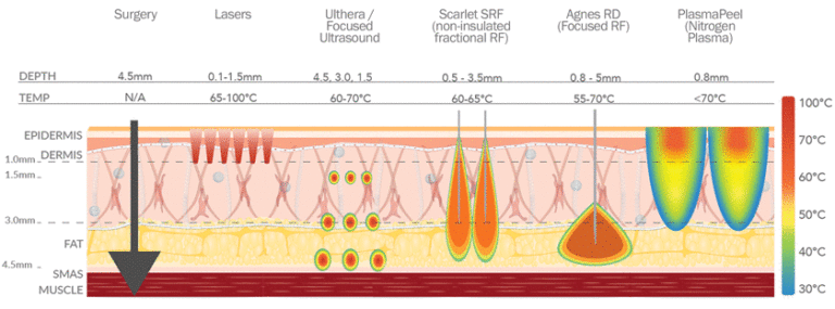 Thermal Damage Comparison