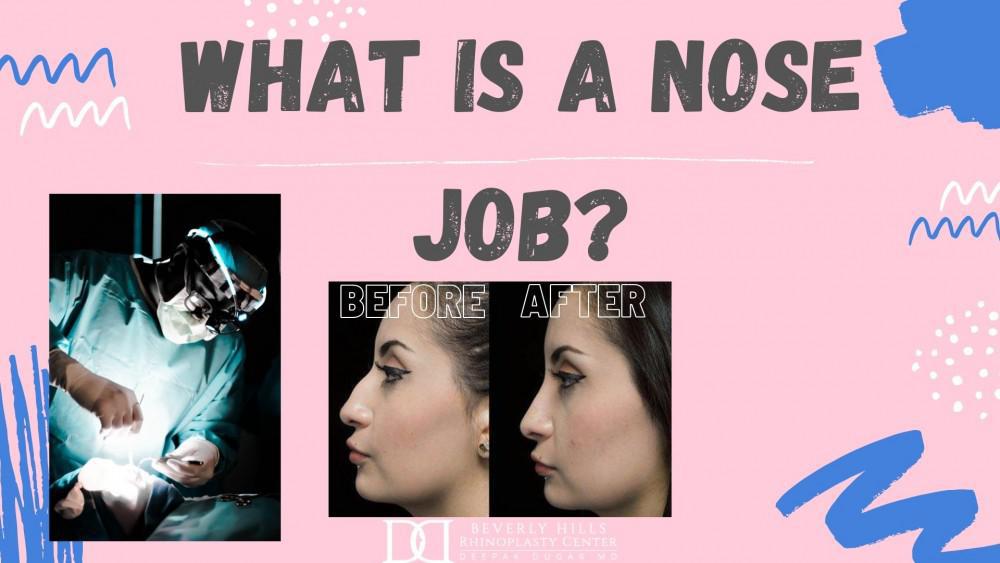 What is a nose job?: Deepak Raj Dugar, MD: Plastic Surgeon